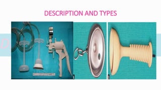 Types Of Vacuum Delivery