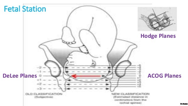 Operative Vaginal Delivery (Dr.Rozan)