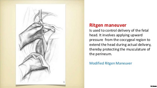 Operative Vaginal Delivery (Dr.Rozan)