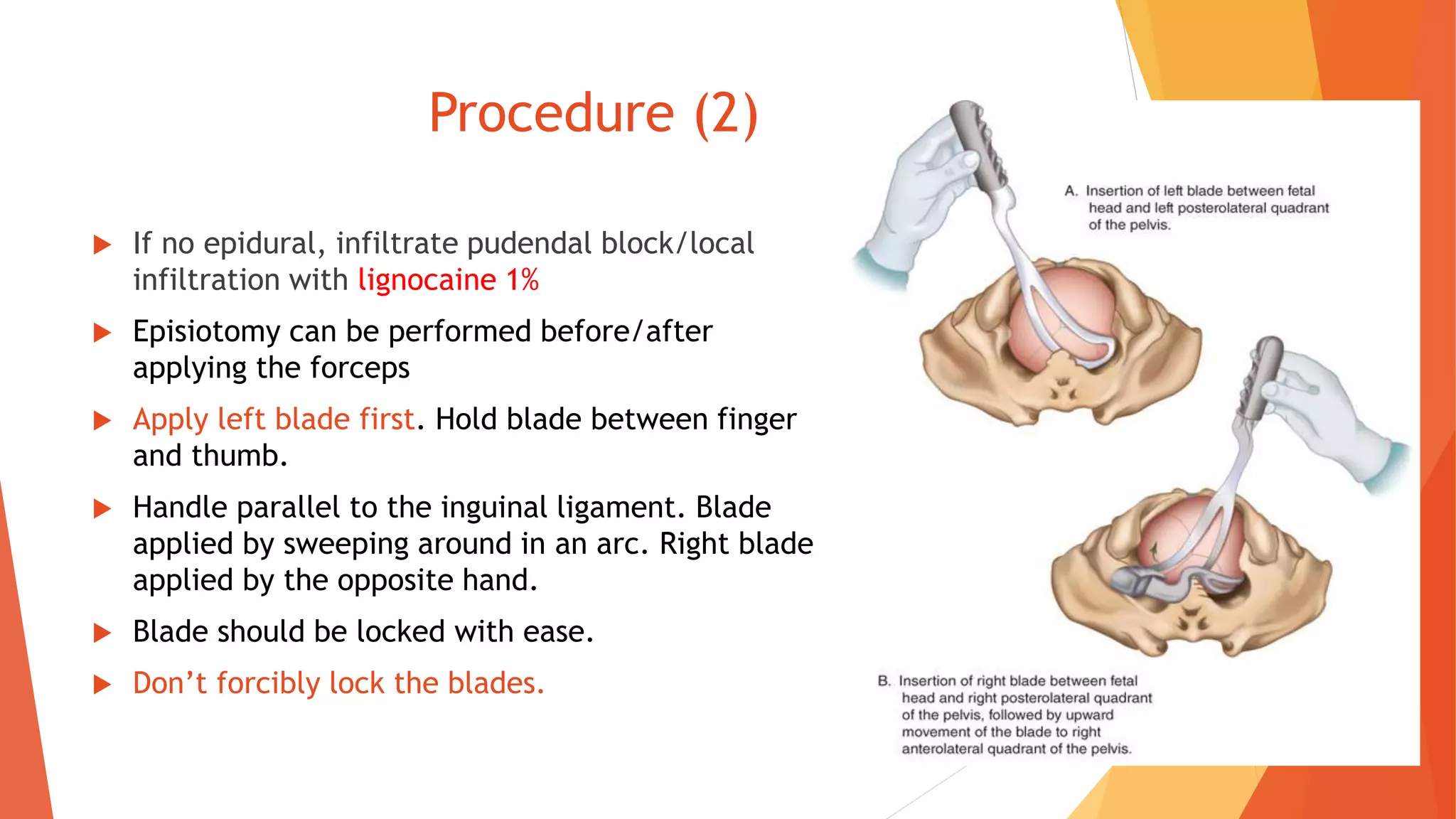 Operative Vaginal Delivery | PPTX