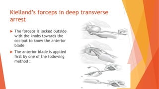 Operative Vaginal Delivery | PPTX