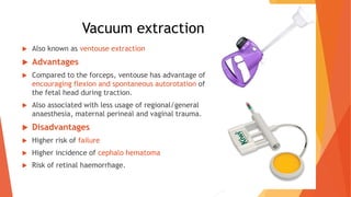 Operative Vaginal Delivery | PPTX