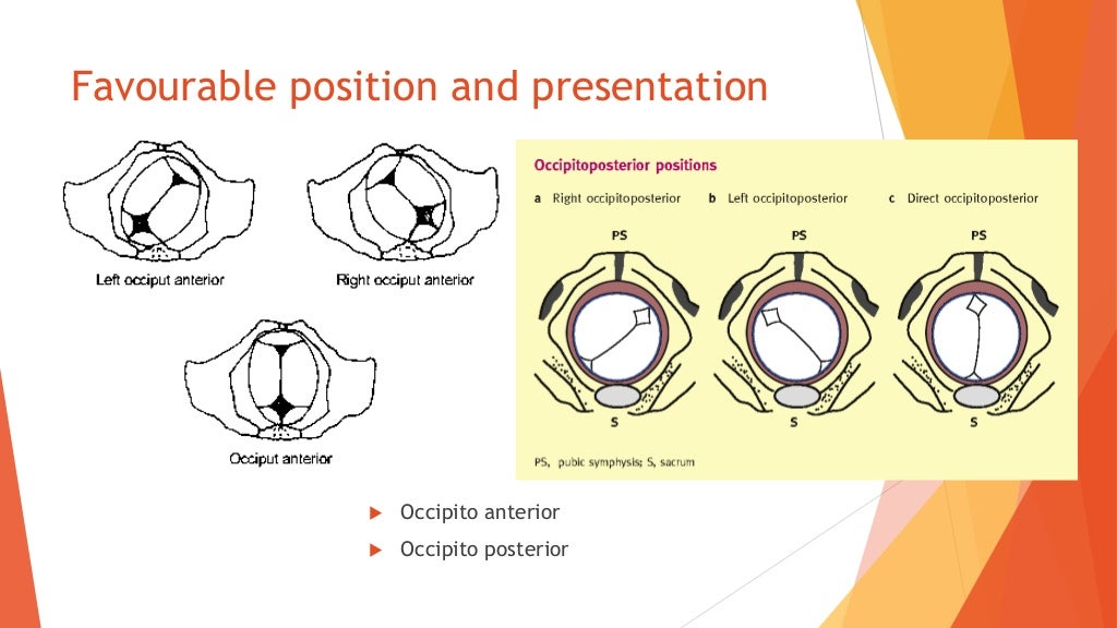 Operative Vaginal Delivery