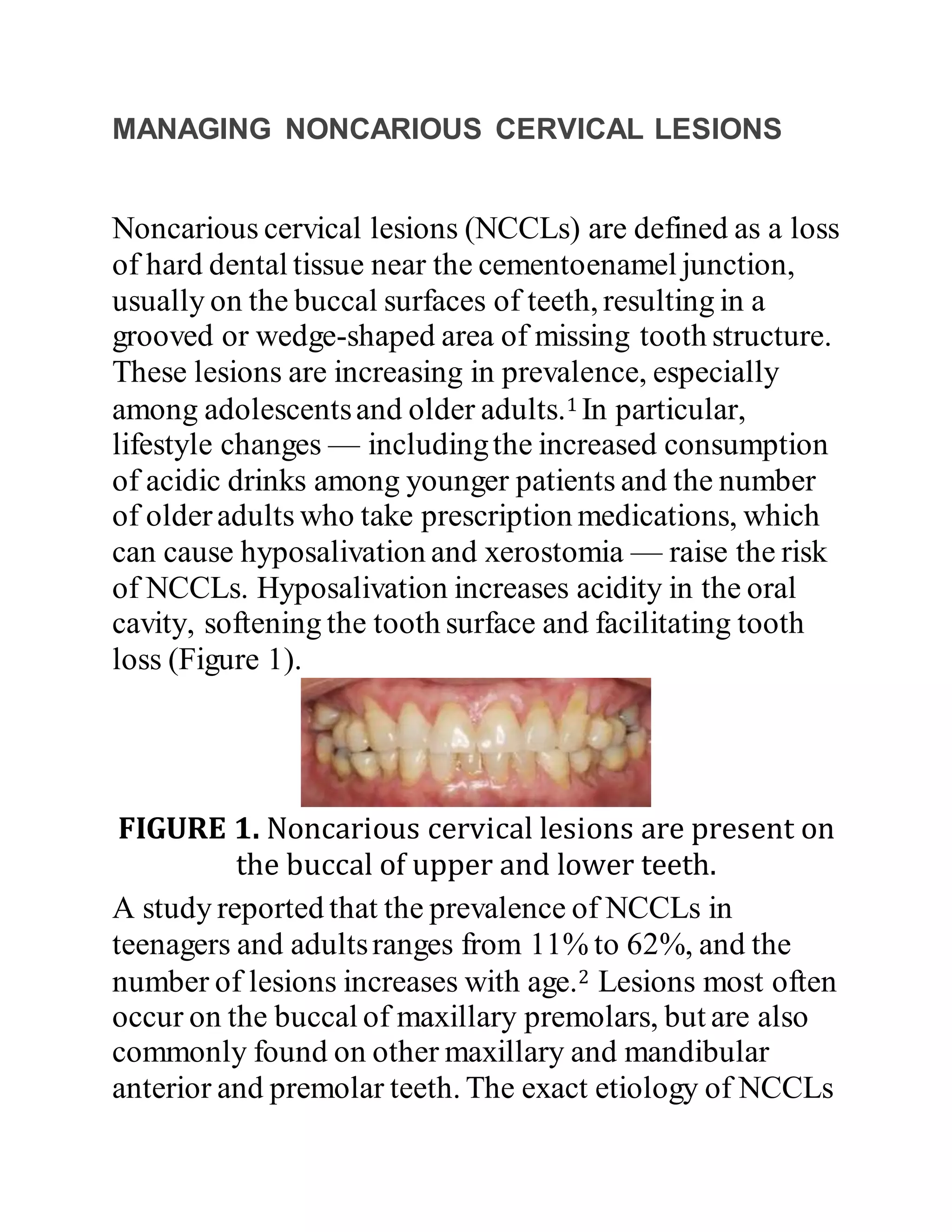 Non carious lesions Operetive research project | DOCX