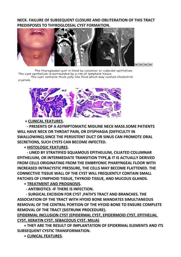 fissural cyst or developmental cyst | ODT