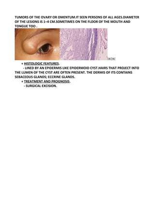 fissural cyst or developmental cyst | ODT