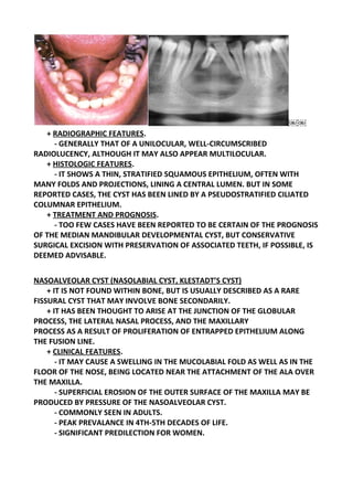 fissural cyst or developmental cyst | ODT