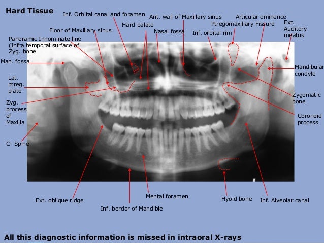 Orthopantomography