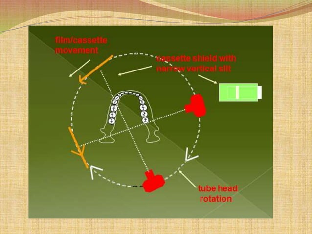 Opg | PPTX | Dental Health | Diseases and Conditions