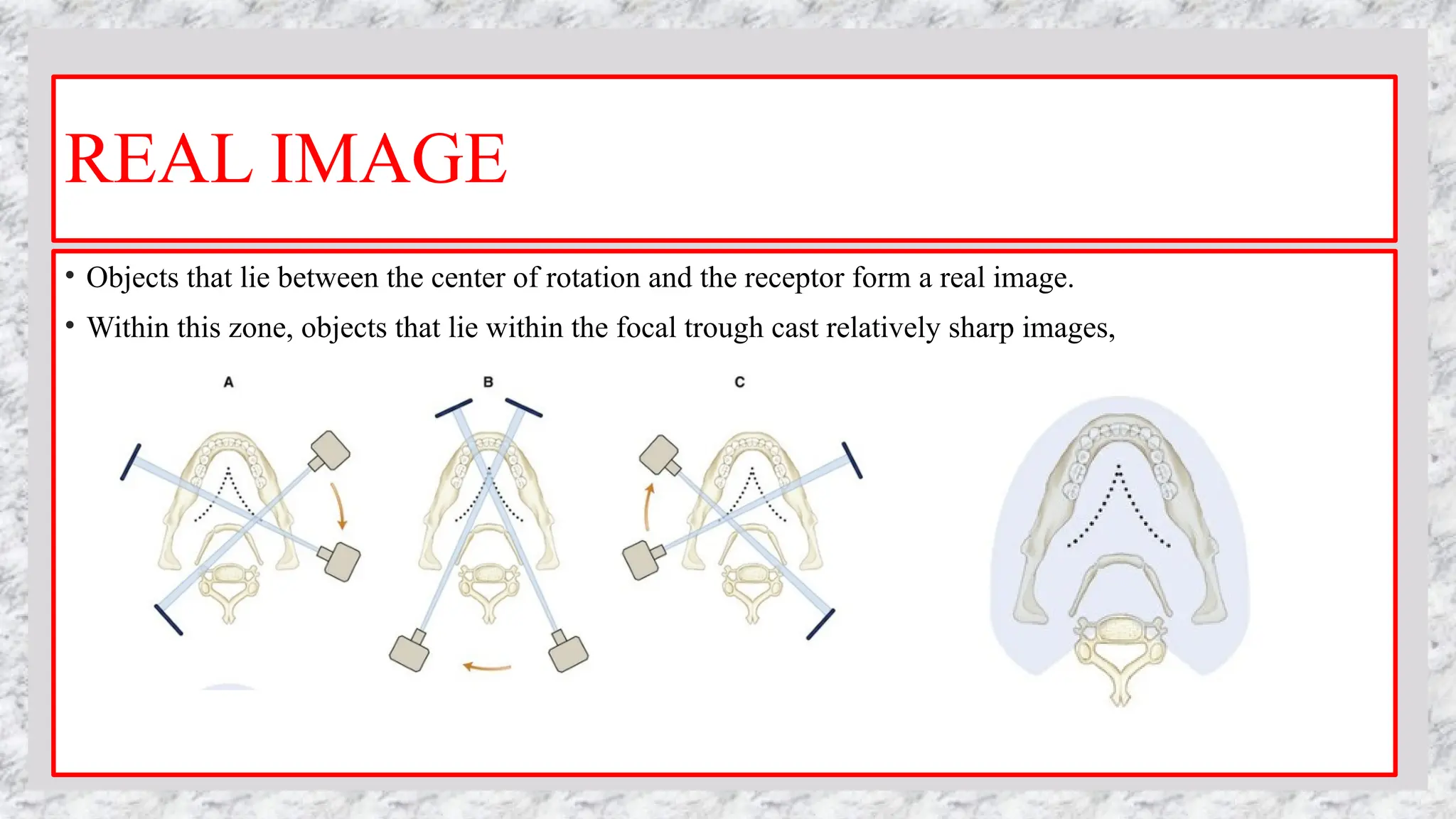 OPG (ORTHOPANTOMOGRAPHY) - PANORAMIC RADIOGRAPHY- DR PRIYANKA | PPTX