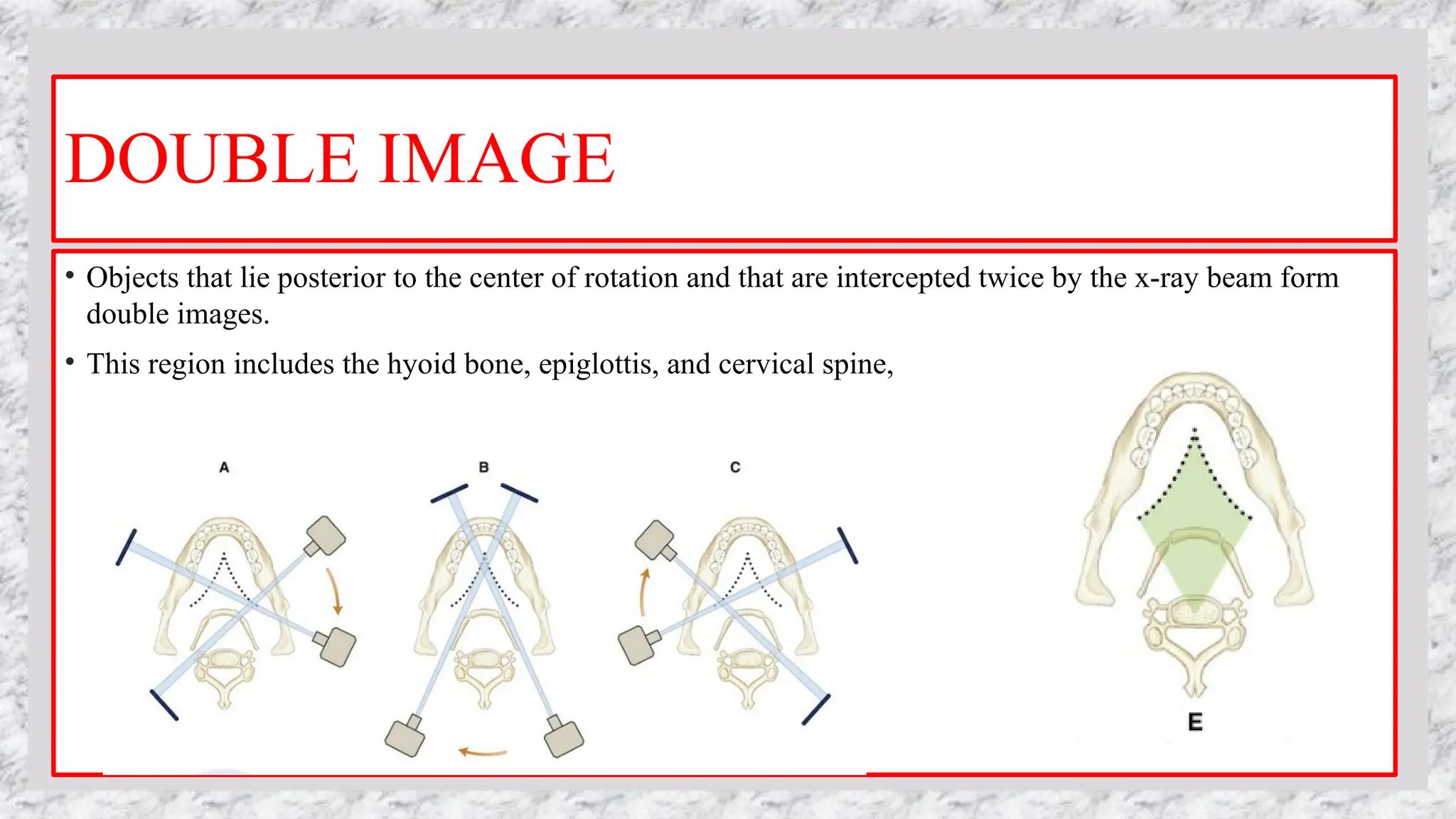 OPG (ORTHOPANTOMOGRAPHY) - PANORAMIC RADIOGRAPHY- DR PRIYANKA | PPTX