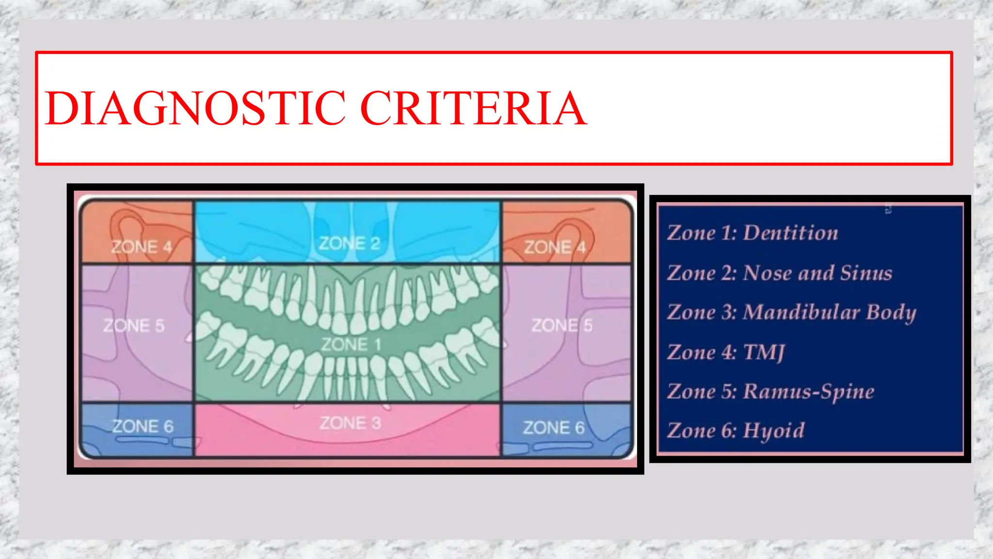 OPG (ORTHOPANTOMOGRAPHY) - PANORAMIC RADIOGRAPHY- DR PRIYANKA | PPTX