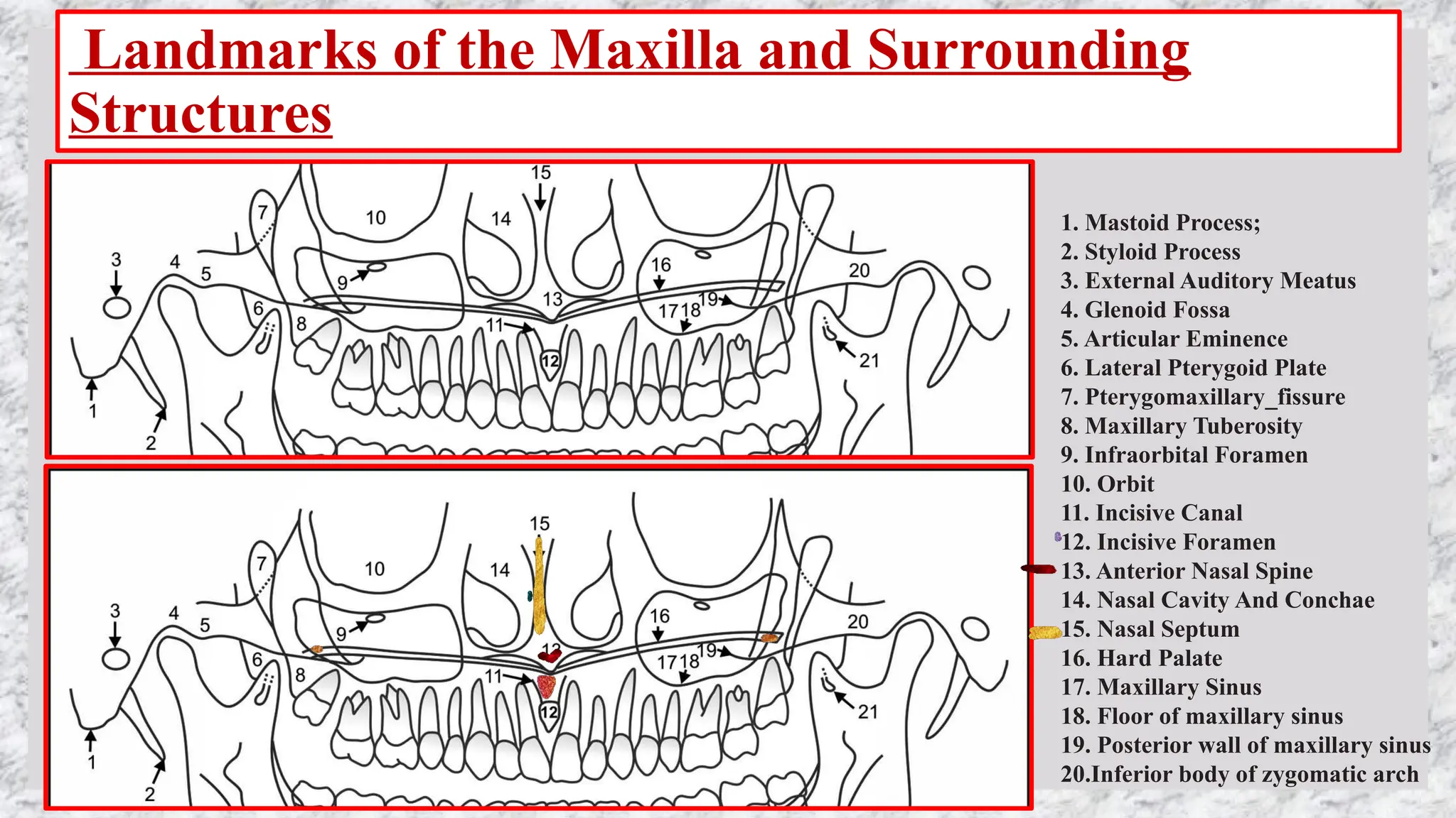 OPG (ORTHOPANTOMOGRAPHY) - PANORAMIC RADIOGRAPHY- DR PRIYANKA | PPTX