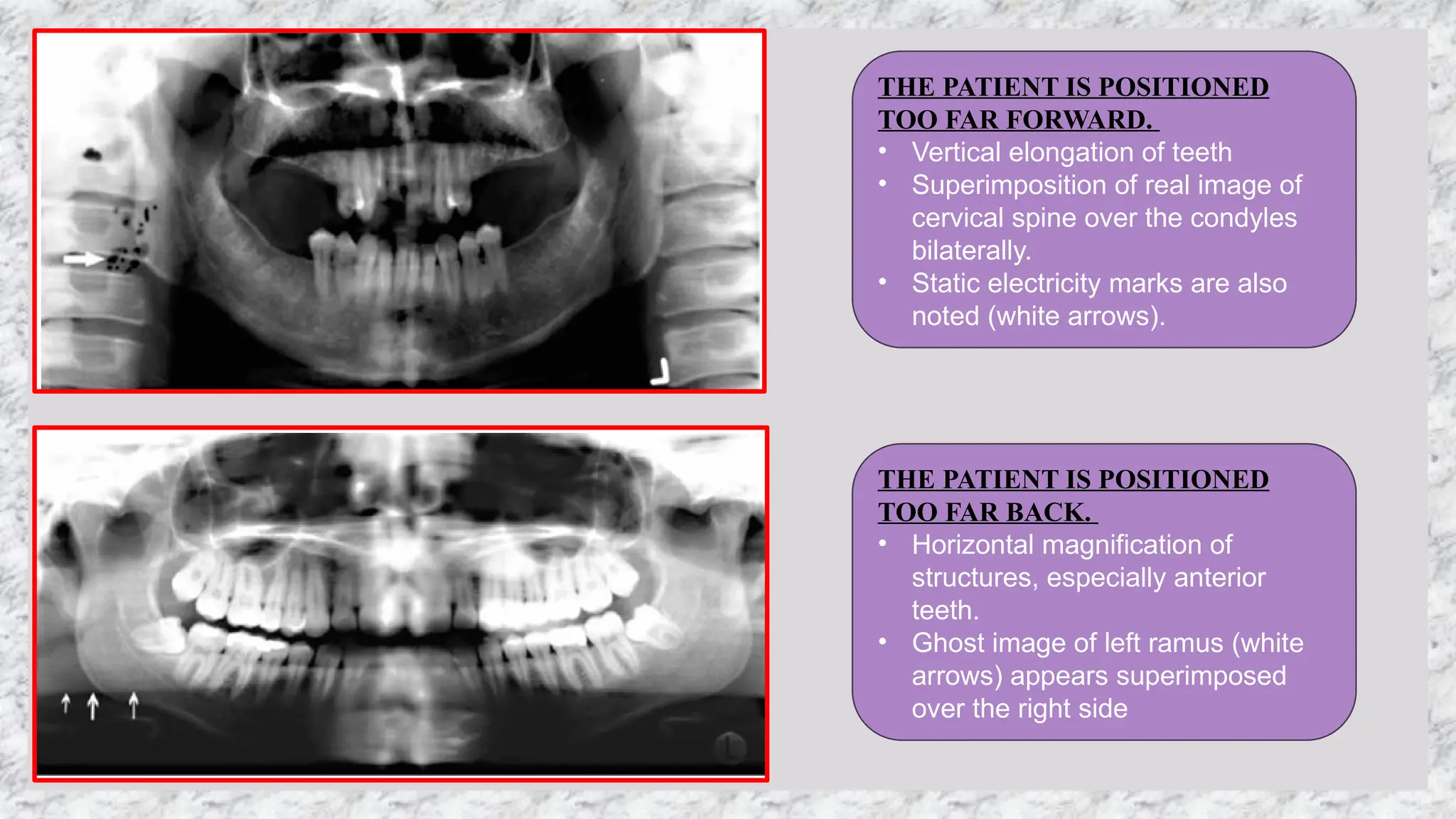 OPG (ORTHOPANTOMOGRAPHY) - PANORAMIC RADIOGRAPHY- DR PRIYANKA | PPTX