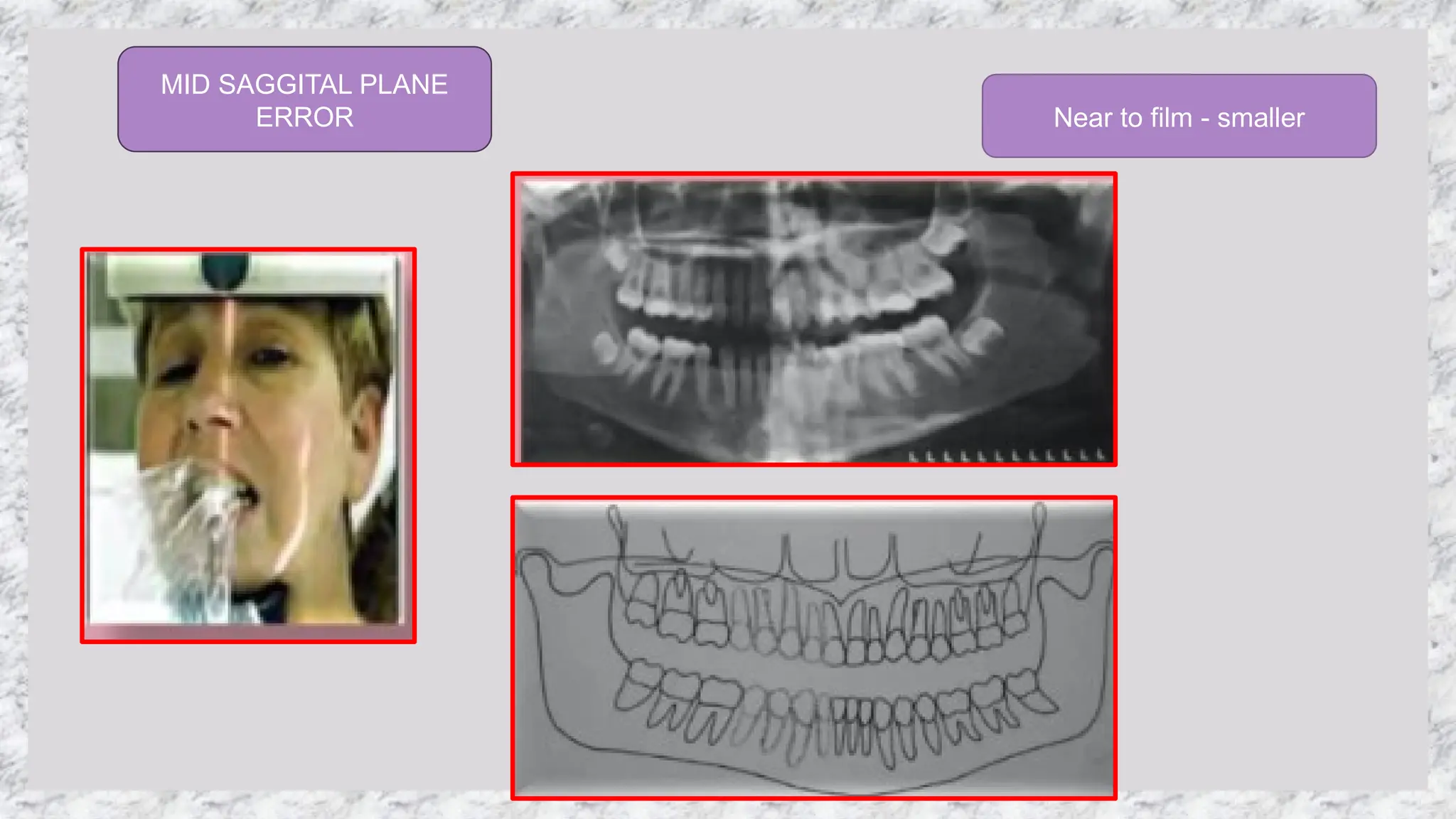 OPG (ORTHOPANTOMOGRAPHY) - PANORAMIC RADIOGRAPHY- DR PRIYANKA | PPTX