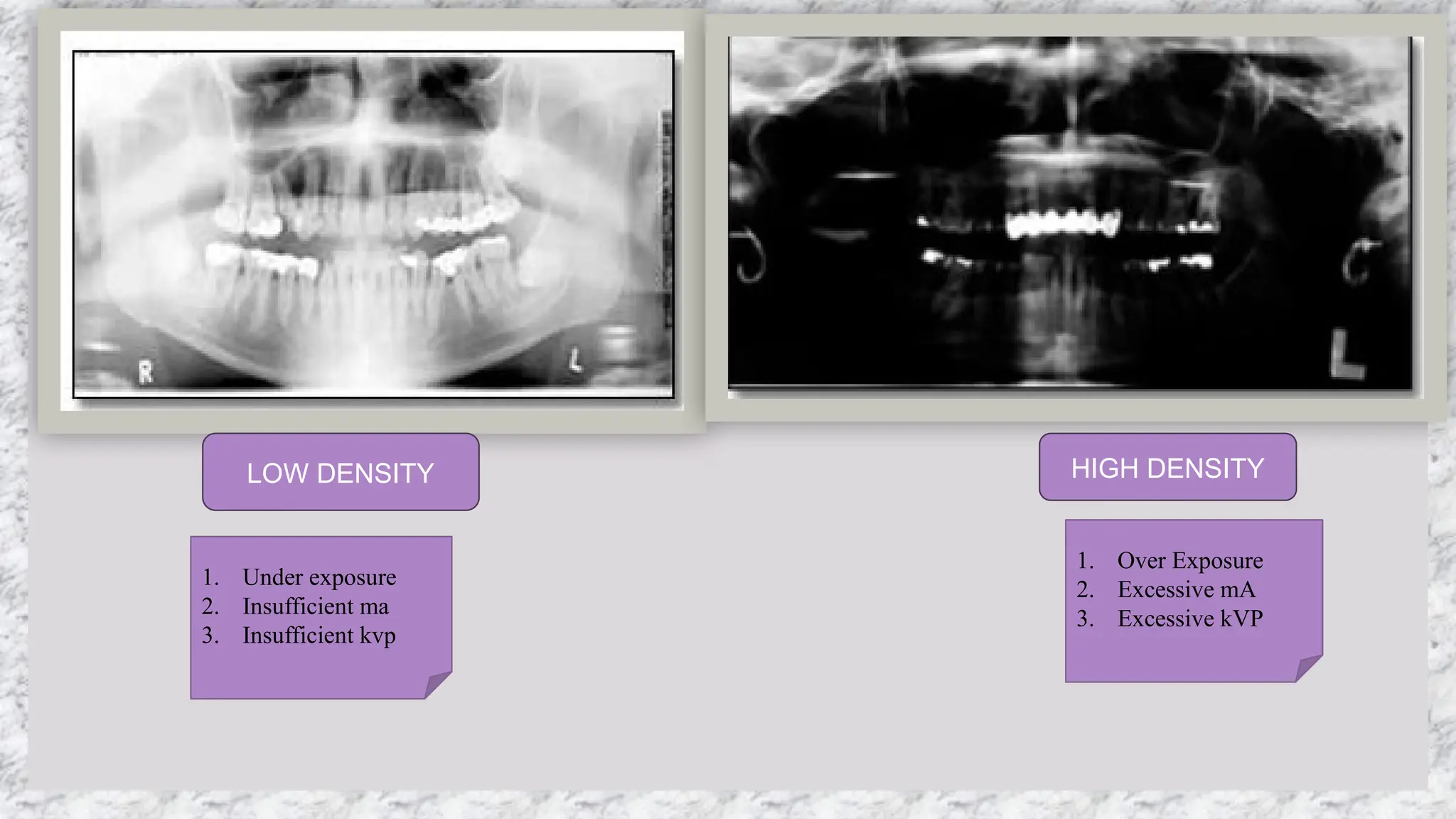 OPG (ORTHOPANTOMOGRAPHY) - PANORAMIC RADIOGRAPHY- DR PRIYANKA | PPTX