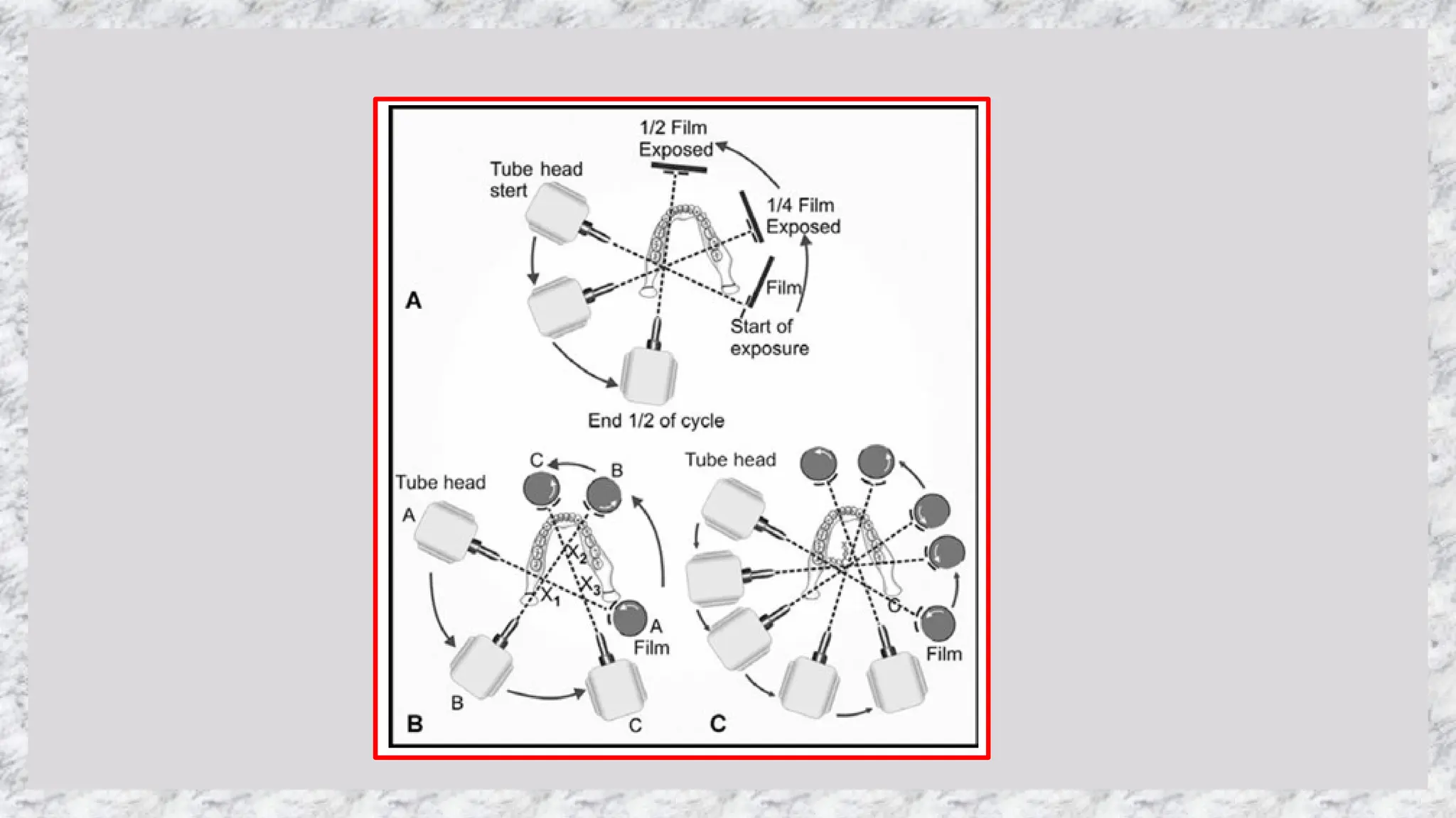 OPG (ORTHOPANTOMOGRAPHY) - PANORAMIC RADIOGRAPHY- DR PRIYANKA | PPTX