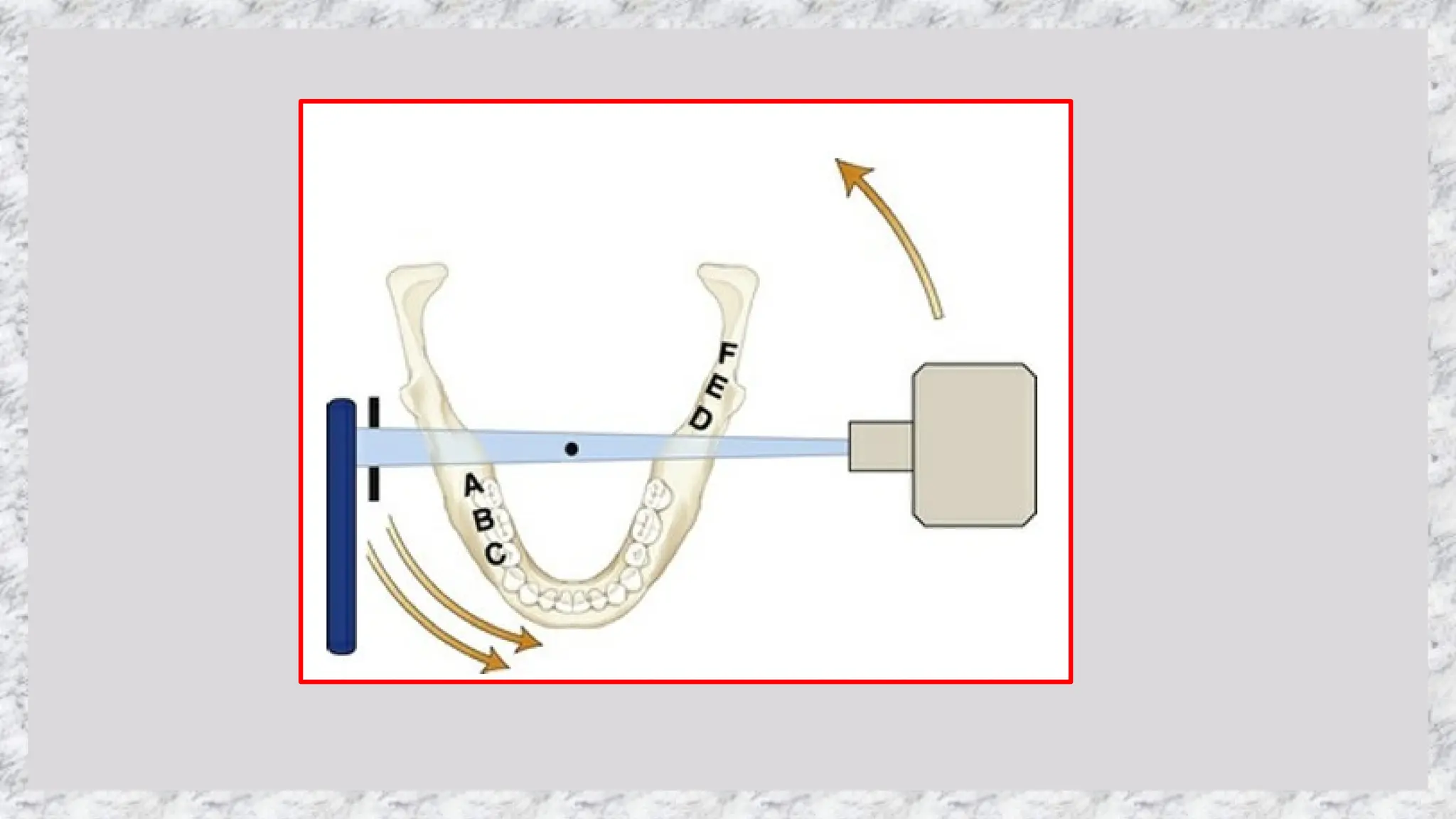 OPG (ORTHOPANTOMOGRAPHY) - PANORAMIC RADIOGRAPHY- DR PRIYANKA | PPTX