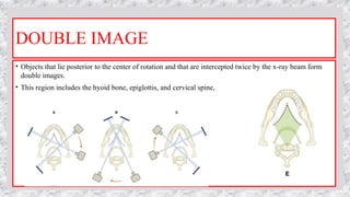 OPG (ORTHOPANTOMOGRAPHY) - PANORAMIC RADIOGRAPHY- DR PRIYANKA | PPTX