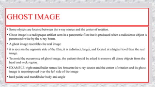 OPG (ORTHOPANTOMOGRAPHY) - PANORAMIC RADIOGRAPHY- DR PRIYANKA | PPTX