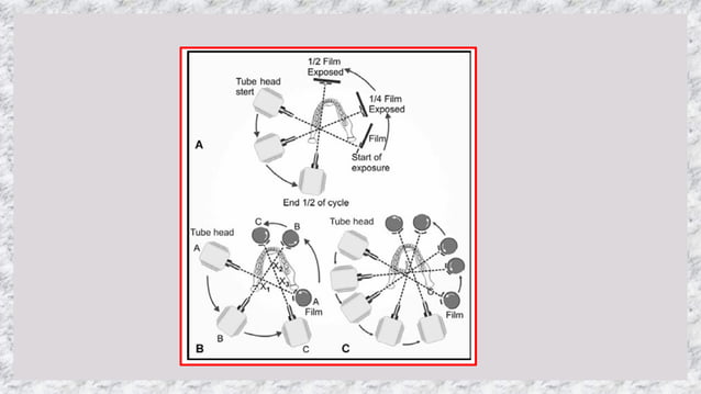 OPG (ORTHOPANTOMOGRAPHY) - PANORAMIC RADIOGRAPHY- DR PRIYANKA | PPTX