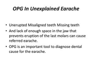 Opg in unexplained earache | PPTX