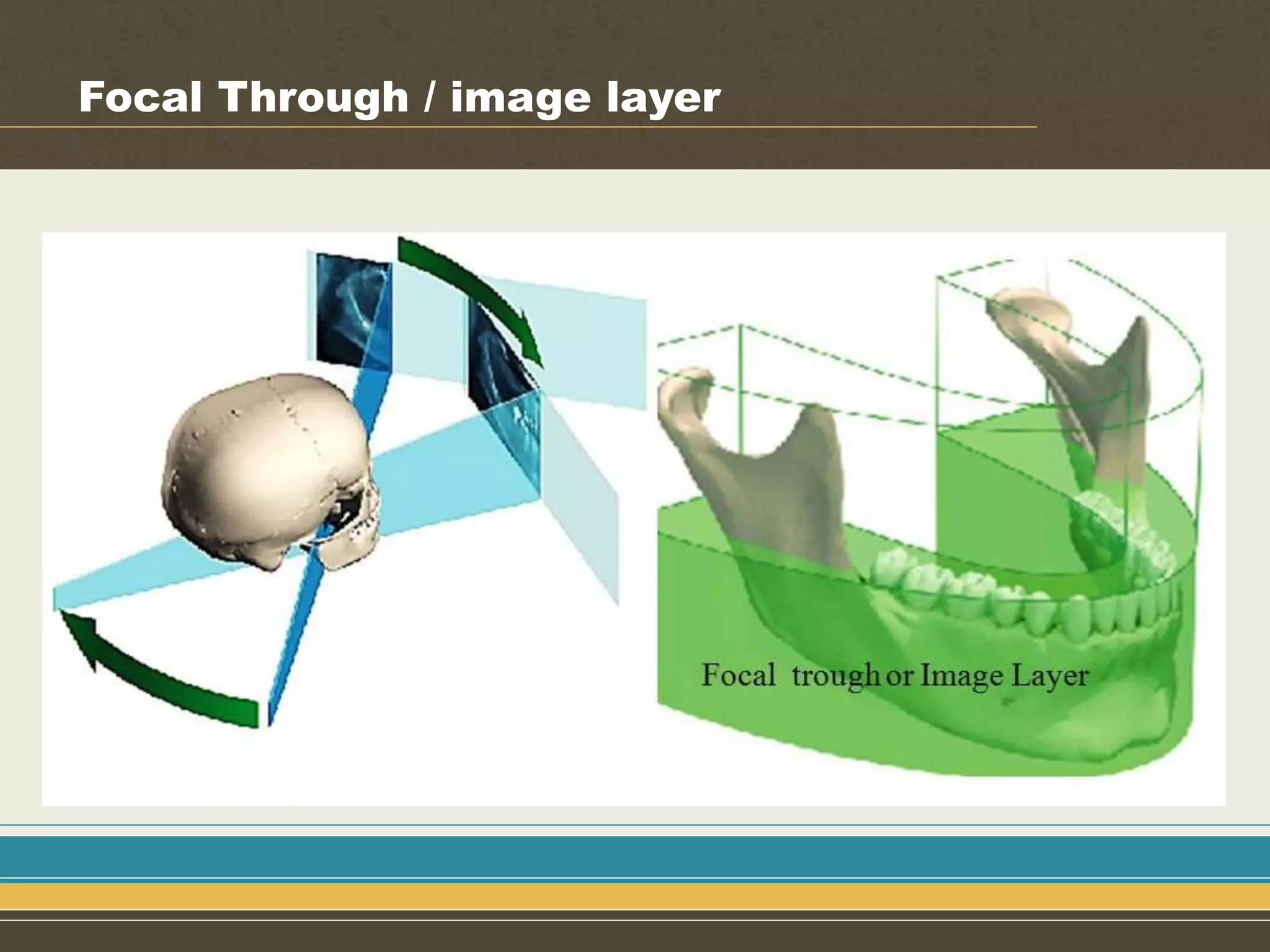 Opg and lateral cephalometric | PPT