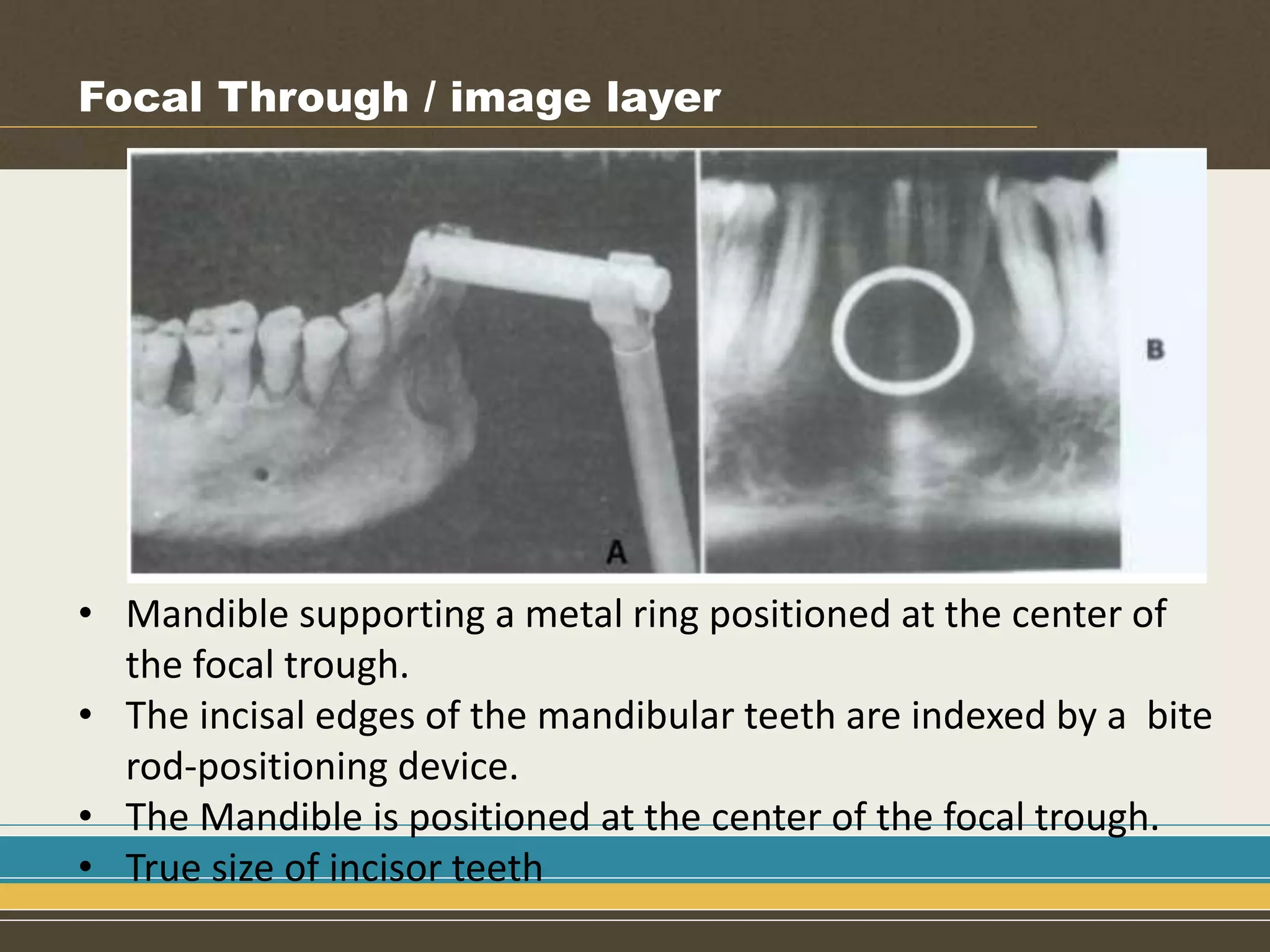 Opg and lateral cephalometric | PPT