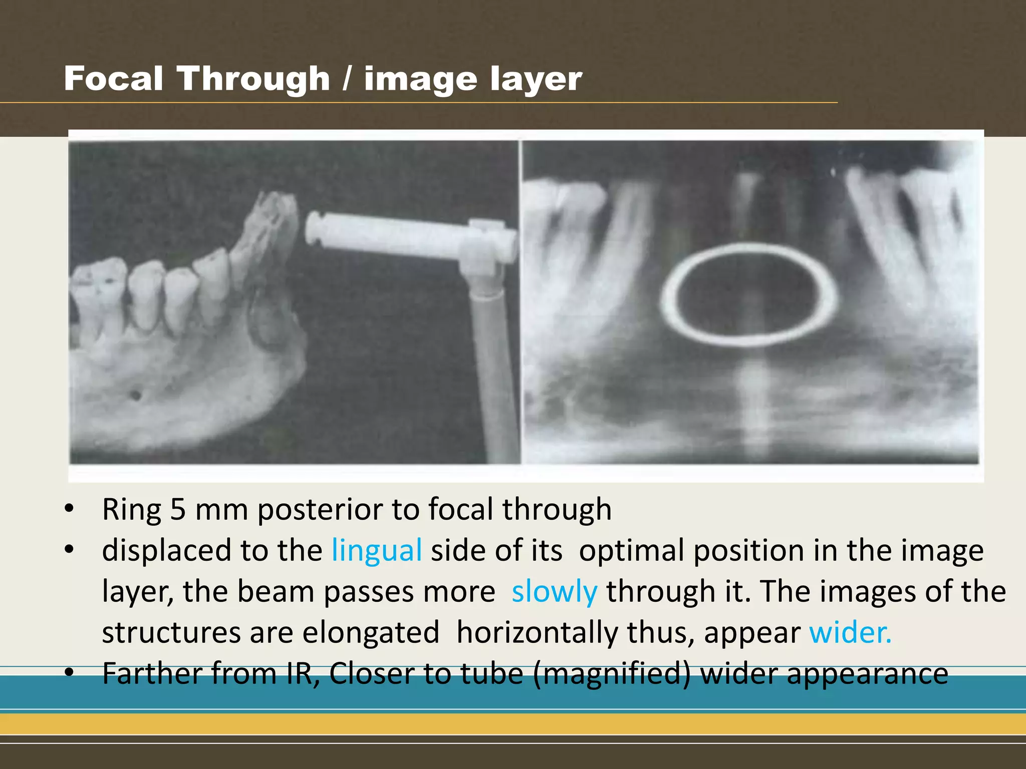 Opg and lateral cephalometric | PPT