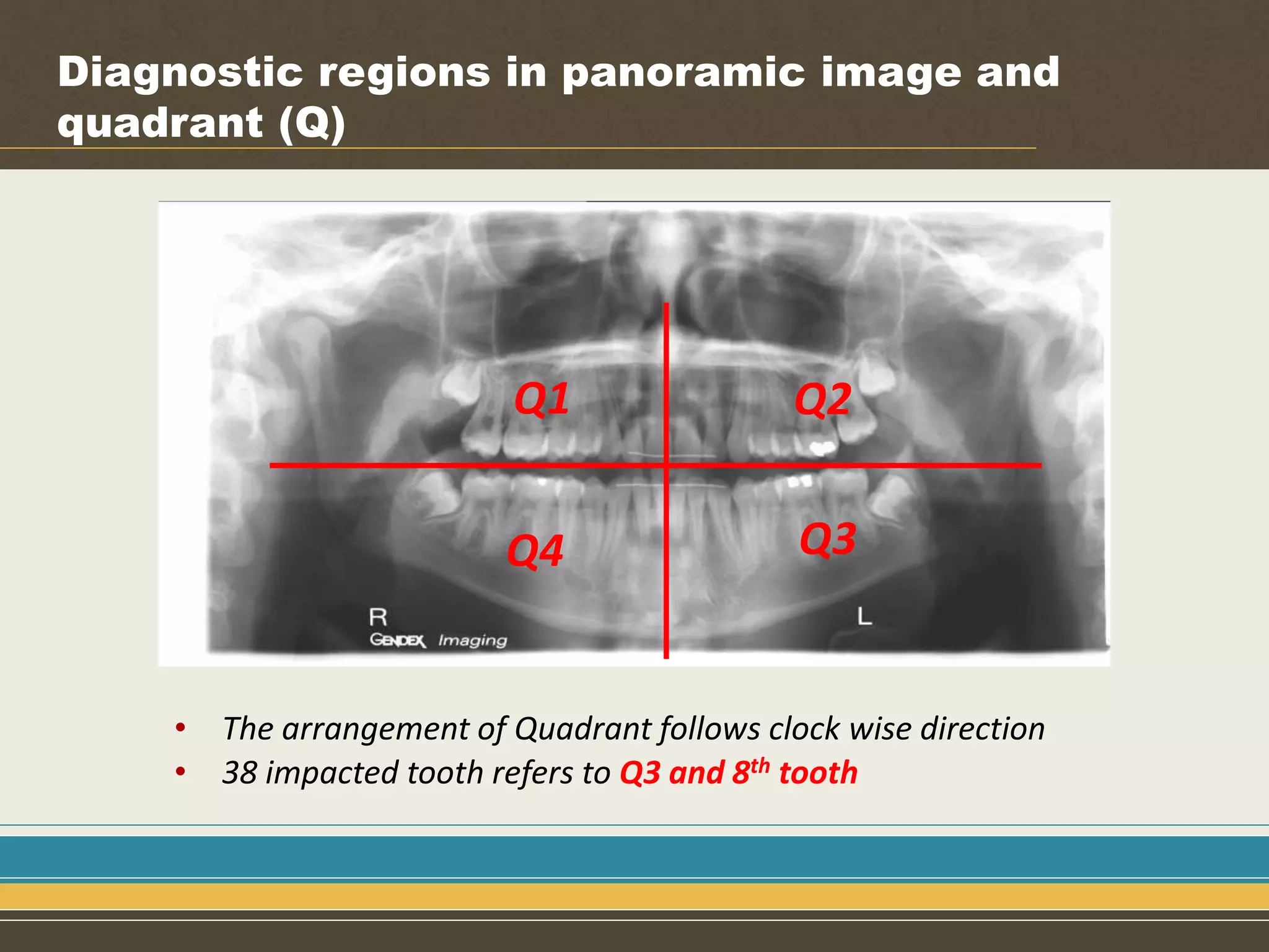 Opg and lateral cephalometric | PPT