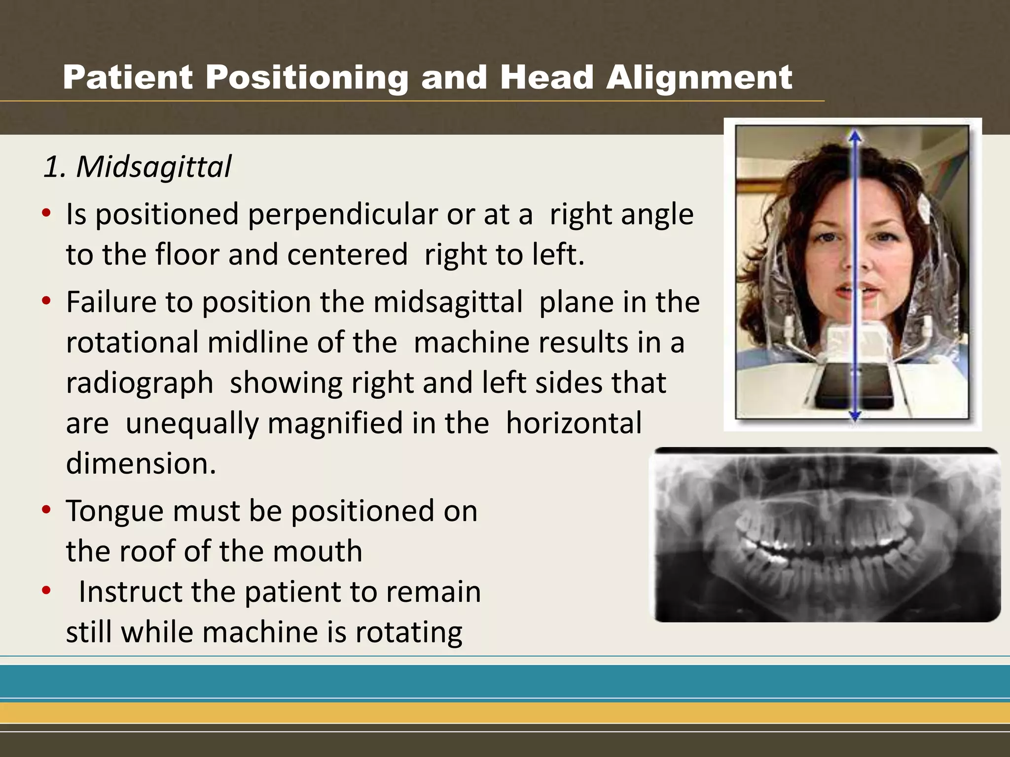 Opg and lateral cephalometric | PPT