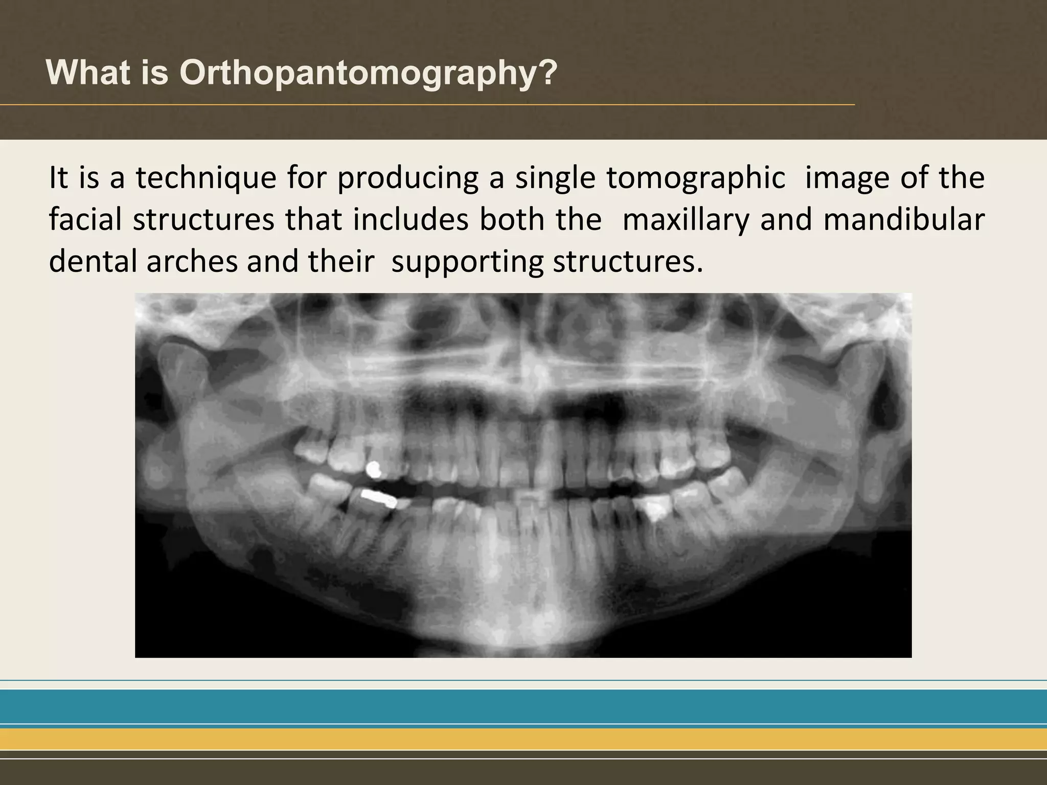 Opg and lateral cephalometric | PPT