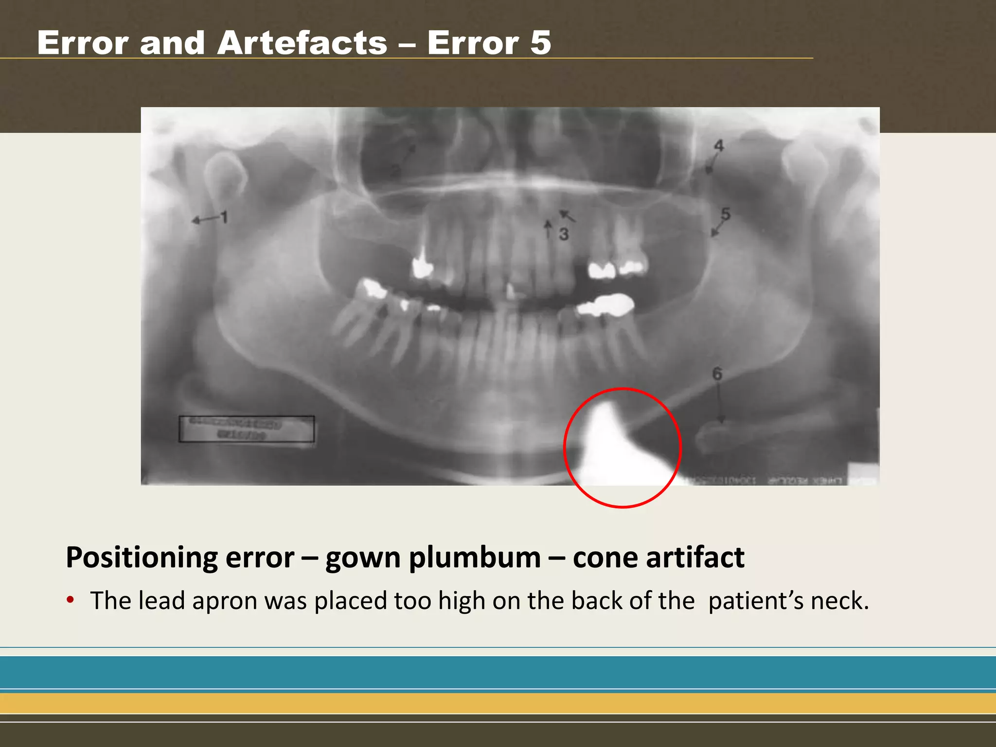 Opg and lateral cephalometric | PPT