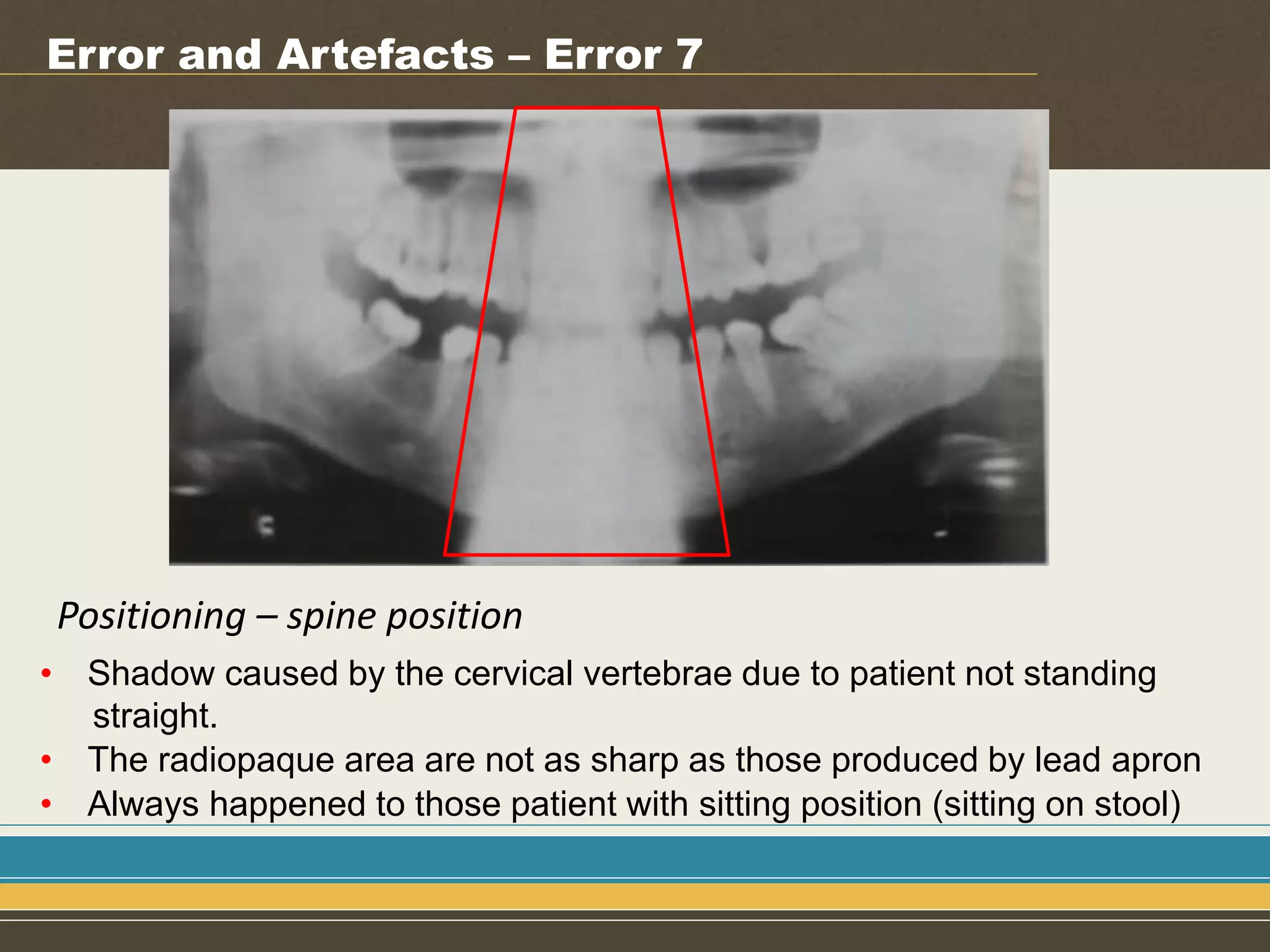 Opg and lateral cephalometric | PPT