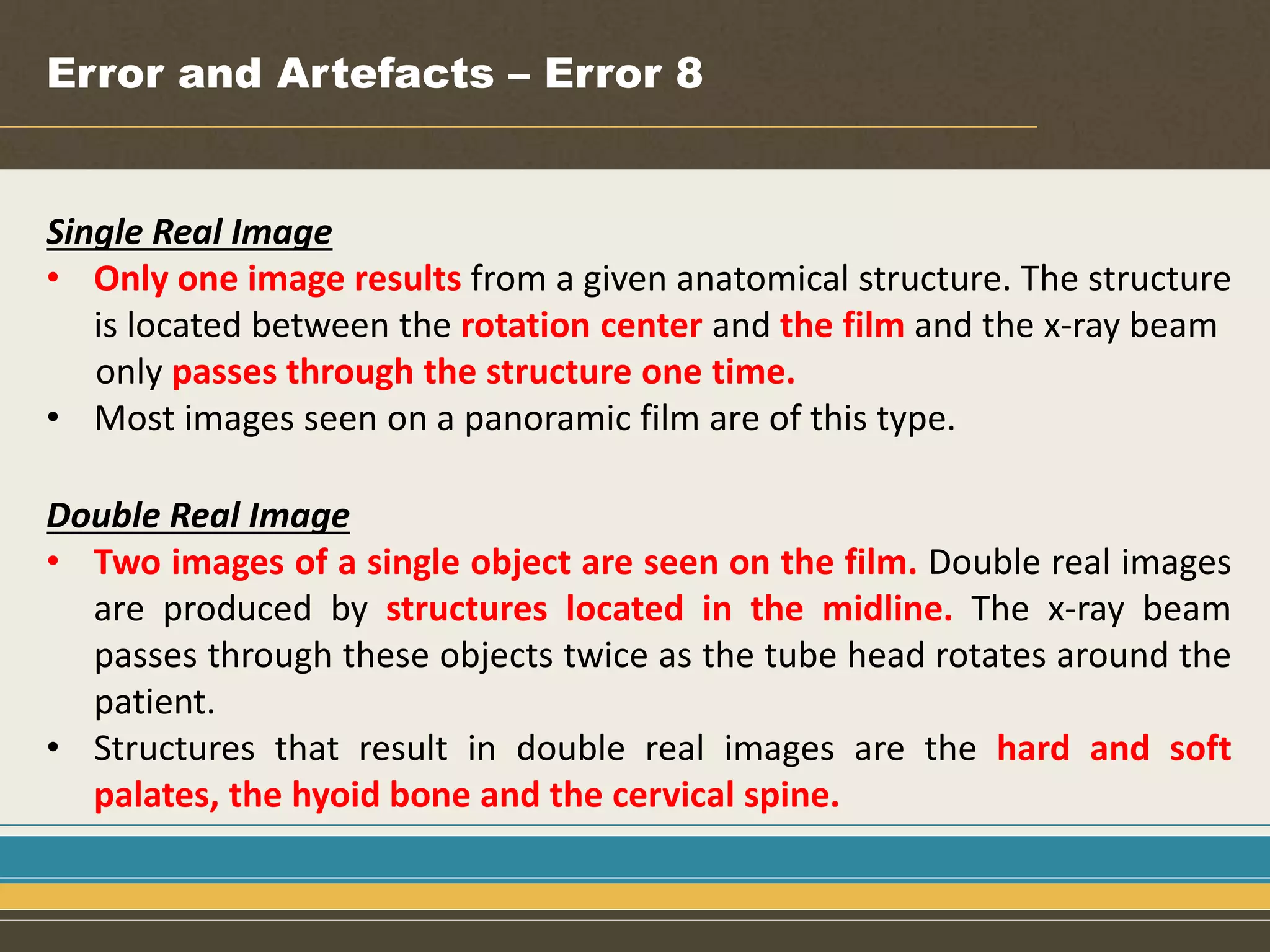 Opg and lateral cephalometric | PPT
