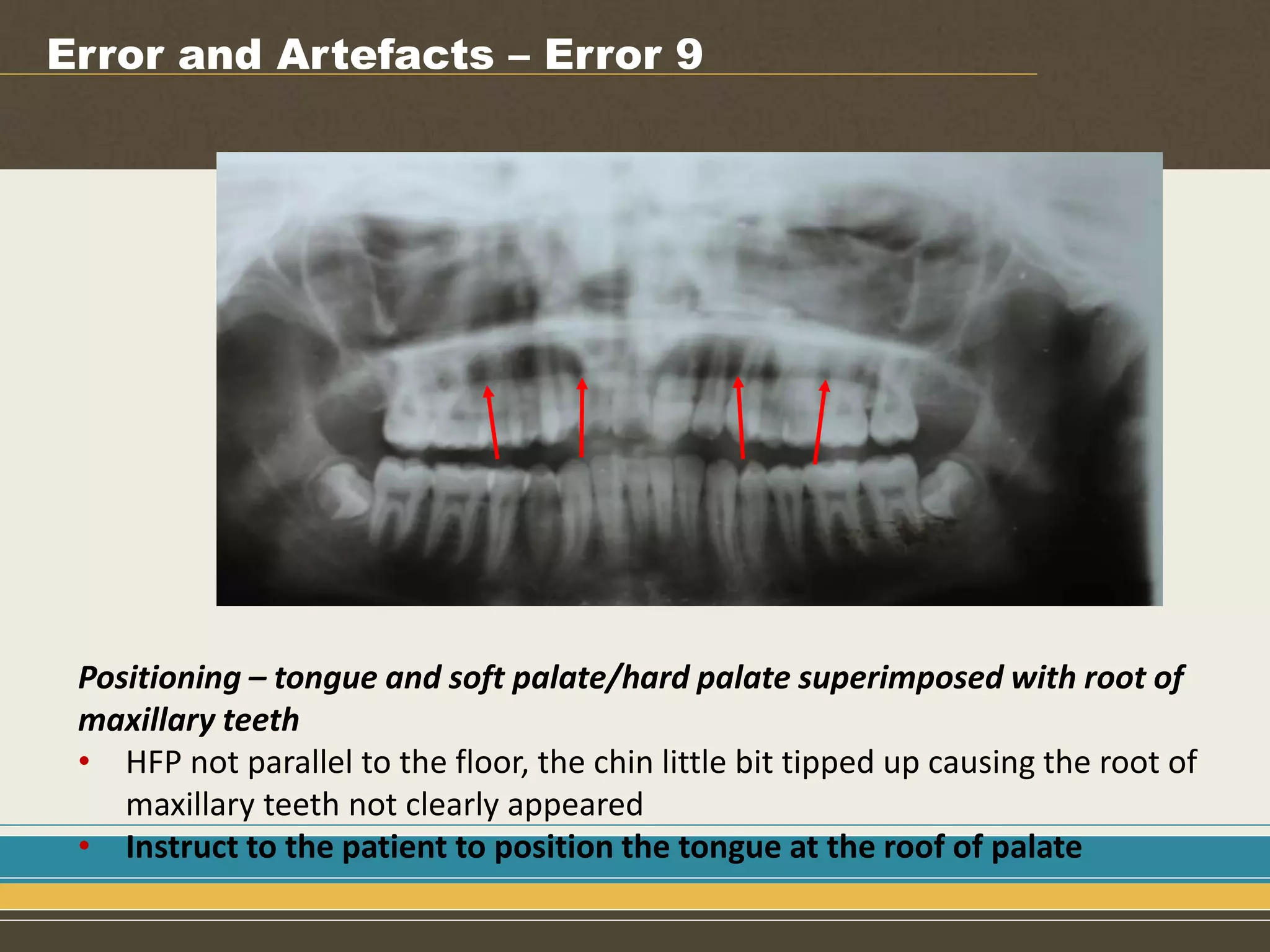 Opg and lateral cephalometric | PPT