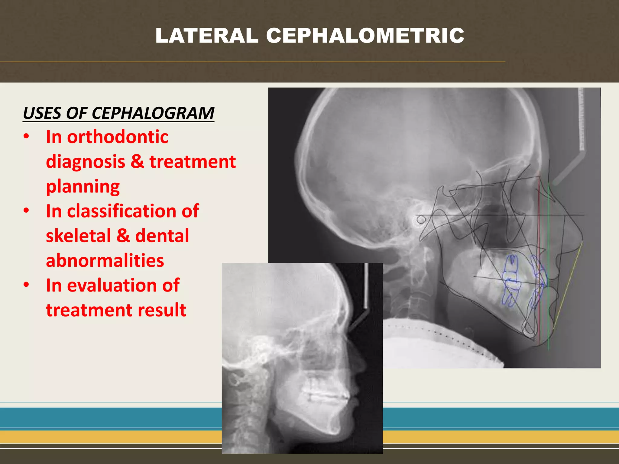Opg and lateral cephalometric | PPT