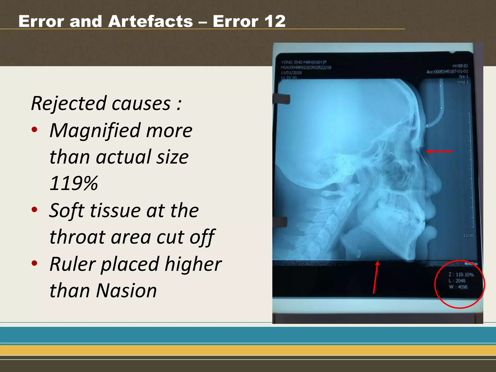 Opg and lateral cephalometric | PPT