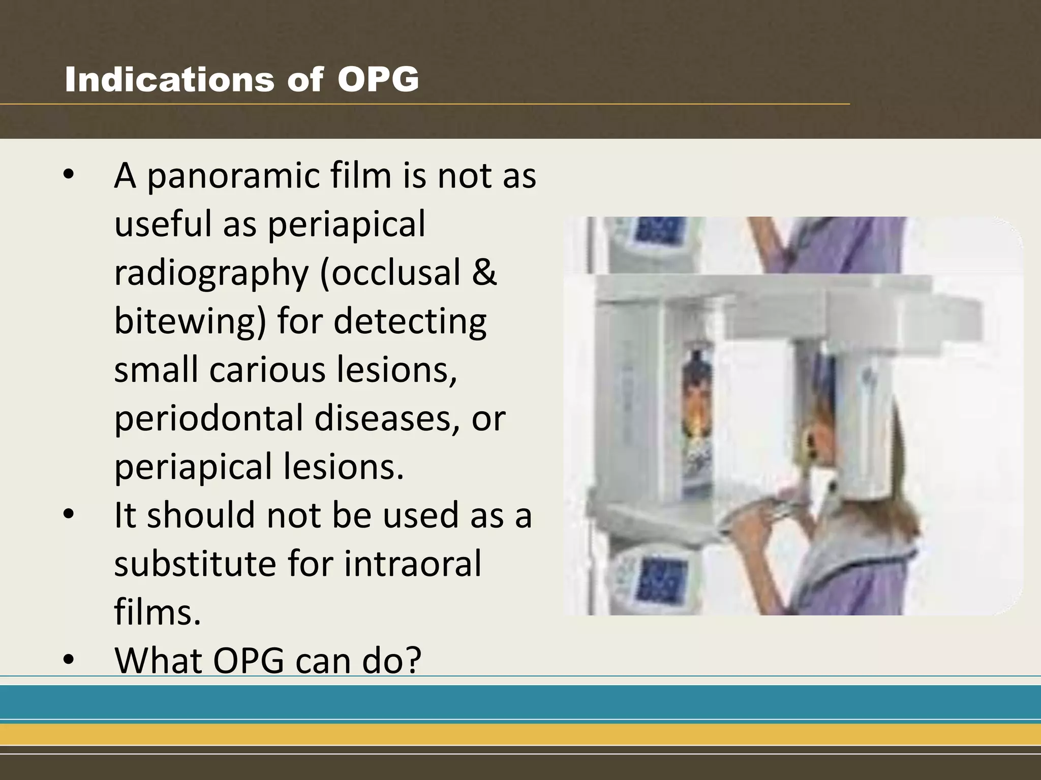 Opg and lateral cephalometric | PPT