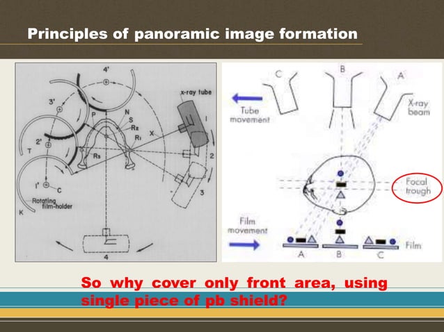 Opg and lateral cephalometric | PPT | Dental Health | Diseases and ...