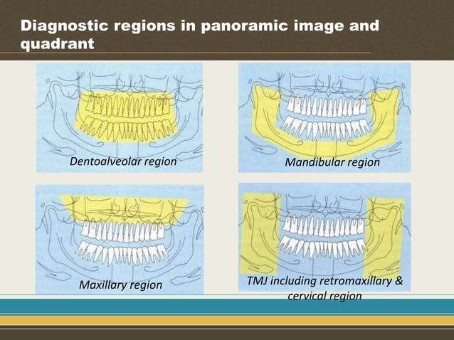 Opg and lateral cephalometric | PPT | Dental Health | Diseases and ...