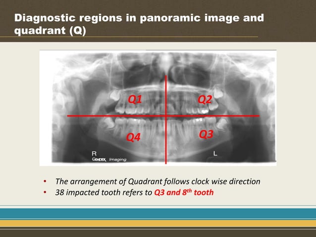 Opg and lateral cephalometric | PPT | Dental Health | Diseases and ...