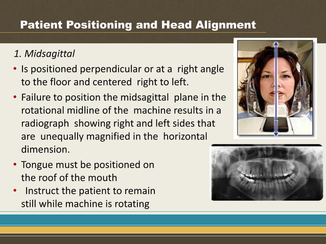 Opg and lateral cephalometric | PPT | Dental Health | Diseases and ...