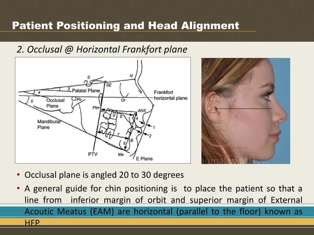 Opg and lateral cephalometric | PPT | Dental Health | Diseases and ...