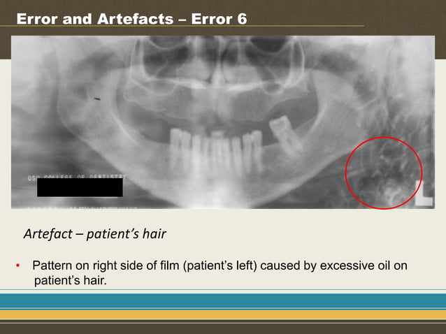 Opg and lateral cephalometric | PPT | Dental Health | Diseases and ...