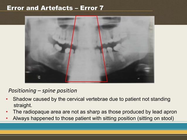 Opg and lateral cephalometric | PPT | Dental Health | Diseases and ...