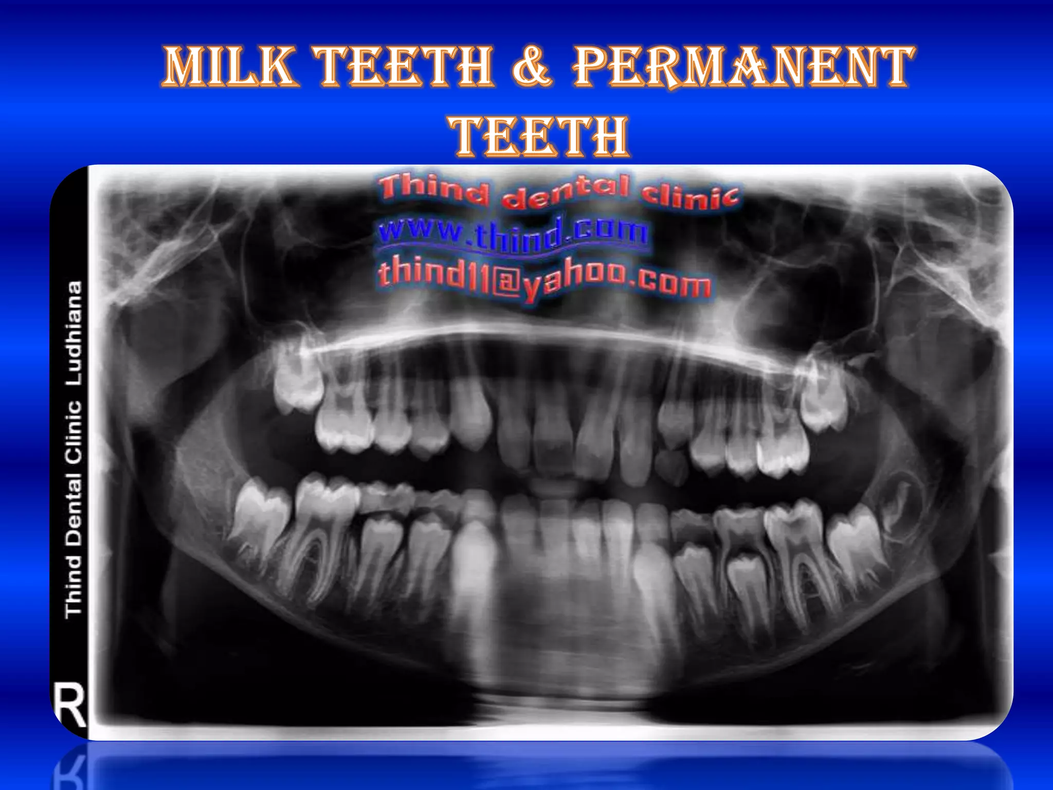 Opg cases ,Thind Dental clinic | PPTX