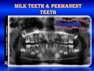 Opg cases ,Thind Dental clinic | PPTX