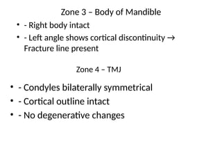 Fracture of opg interpretation of left side | PPTX