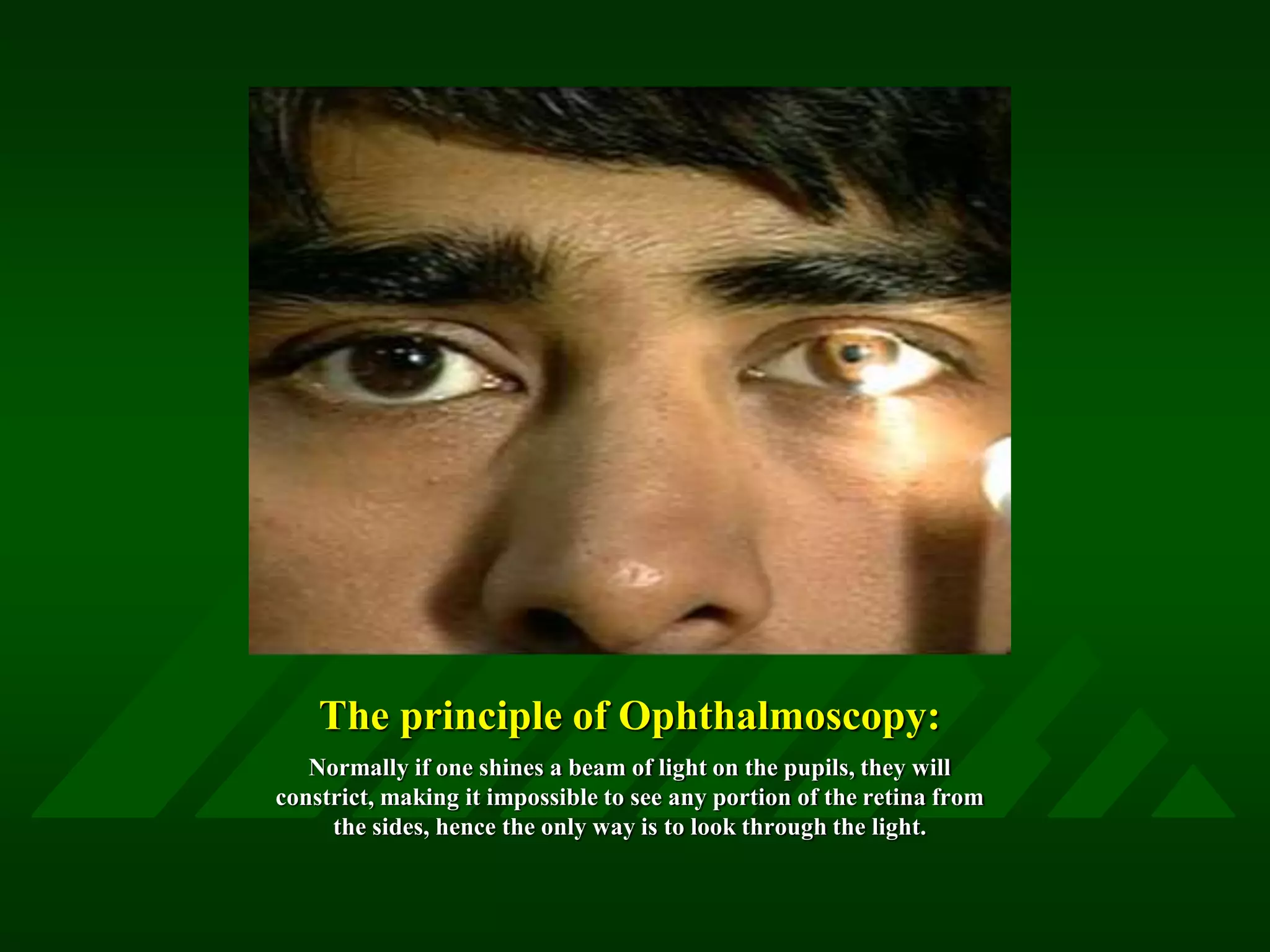 Principles of Ophthalmoscopy | PPTX